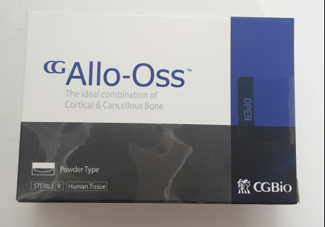 알로오스 (Allo-Oss) : 네이버 블로그