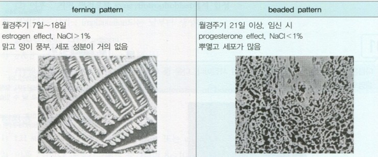 cervical mucus (자궁경관점액) : 네이버 블로그