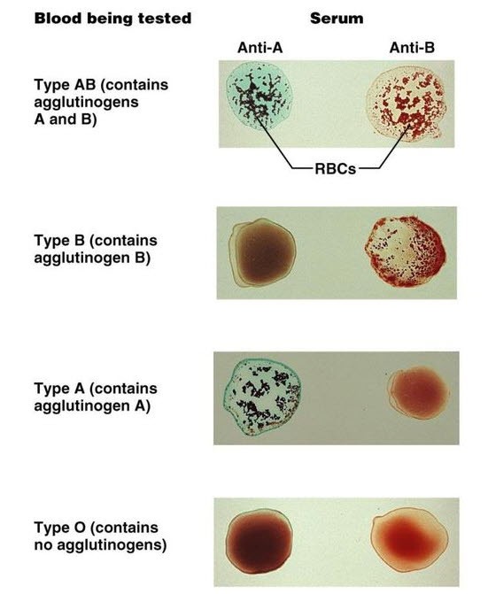 혈액은행 혈액형(ABO, Rh) 검사 : 네이버 블로그