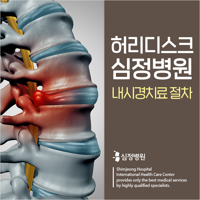 구로정형외과 허리디스크 내시경치료 절차 네이버 블로그
