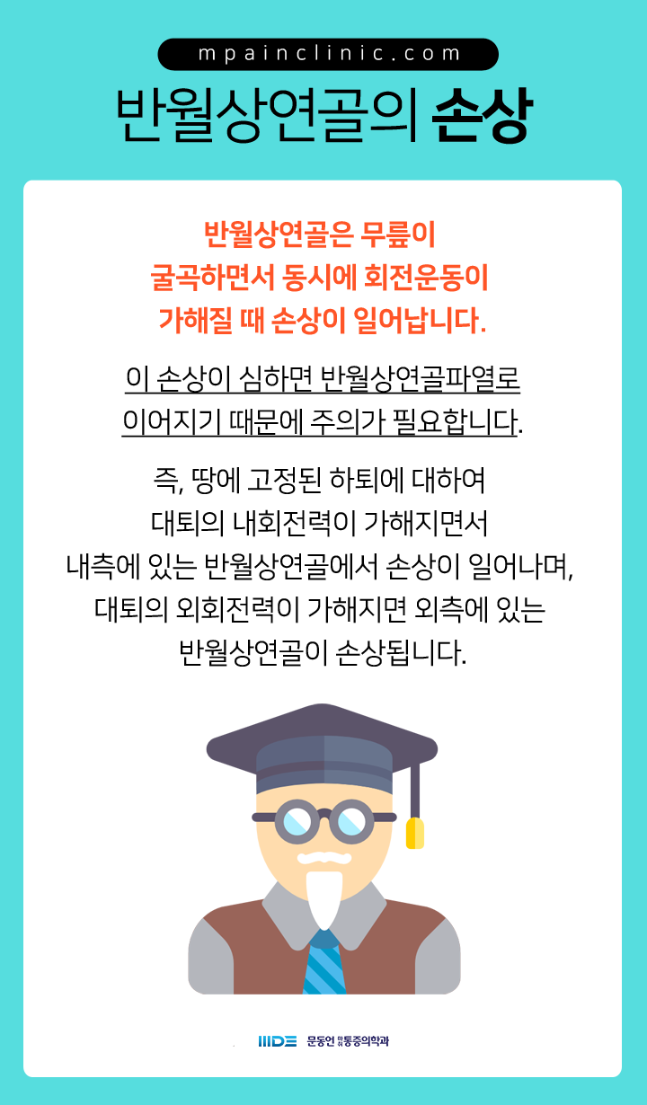 무릎연골찢어짐 시큰한 통증 무릎의 연골 파열 주의하세요 네이버 포스트