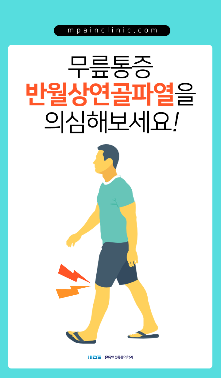 무릎연골찢어짐 시큰한 통증 무릎의 연골 파열 주의하세요 네이버 포스트