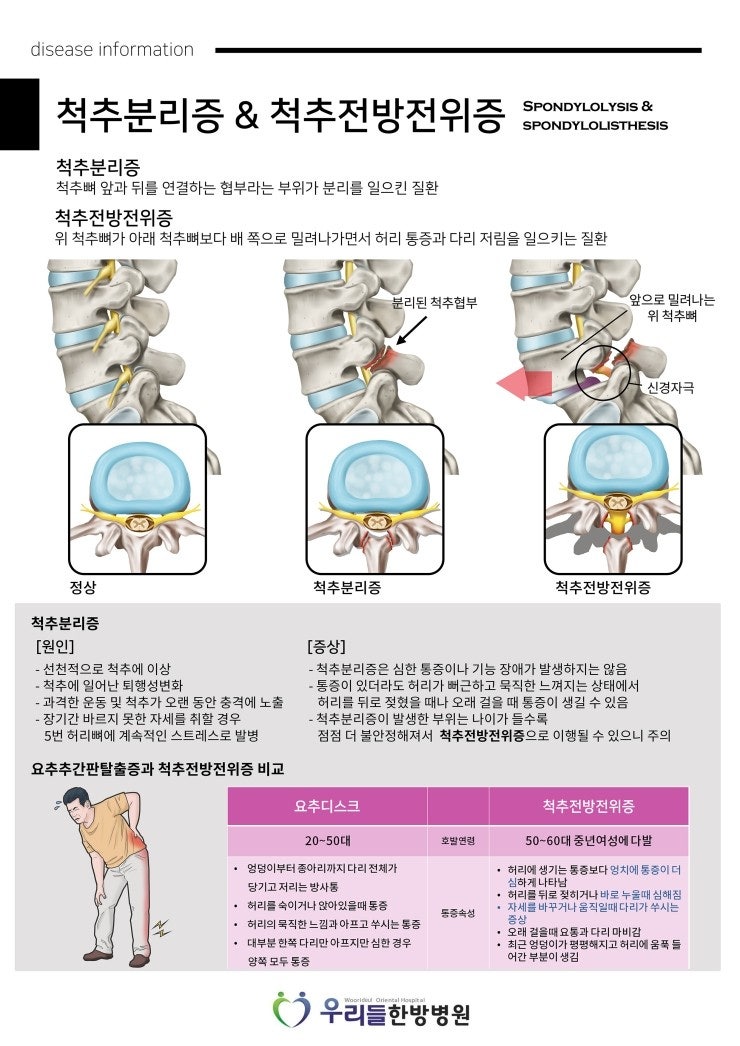 순천 척추전방전위증 척추전방전위증 환자 45예의 요추주변근육의 지방침착도와 전위정도의 상관성에 대한 후향적 연구 한방재활