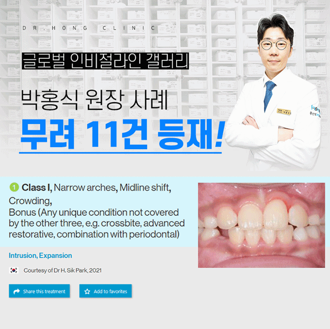 은평구치아교정 인비절라인 글로벌 갤러리에 11건 사례 등재 네이버 블로그
