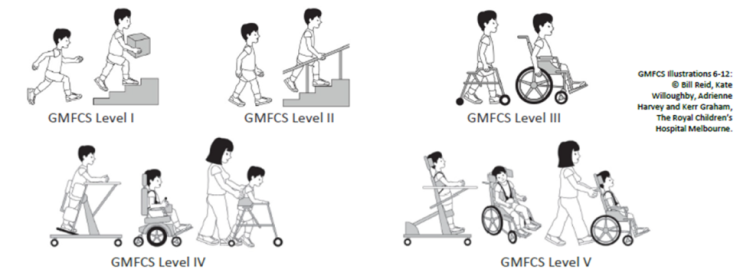 뇌성마비의 '대동작 분류체계(GMFCS, GrossMotorFunction ClassificationSystem )' 평가도구 ...
