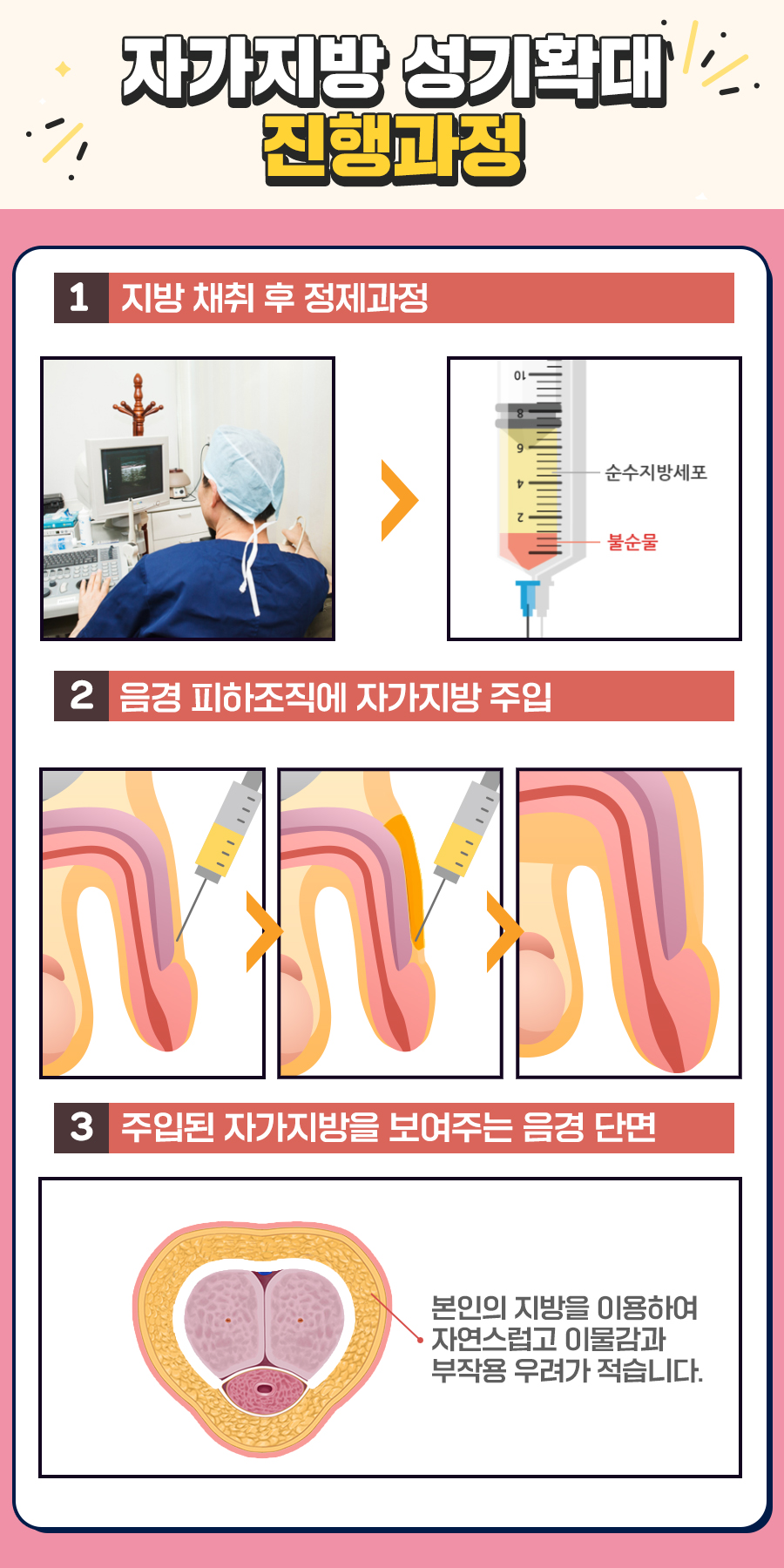 남성성기확대수술 전후 변화를 직접 확인할 수 있습니다 네이버 블로그