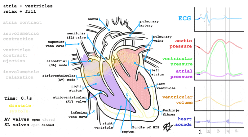 IABP(Intra aortic balloon pump) 대동맥 내 풍선펌프 공부하기 : 네이버 블로그