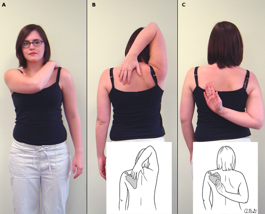 Frozen shoulder, adhesive capsulitis 진단 관련 내용 : 정상 어깨의 range of motion ...