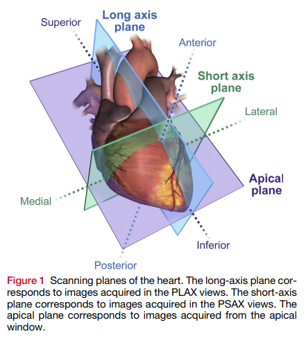 심장초음파(TTE) 2D 영상_apical, subcostal, suprasternal notch window : 네이버 블로그