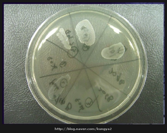 Vancomycin-resistant enterococci (VRE) 선별검사와 확인검사 : 네이버 블로그
